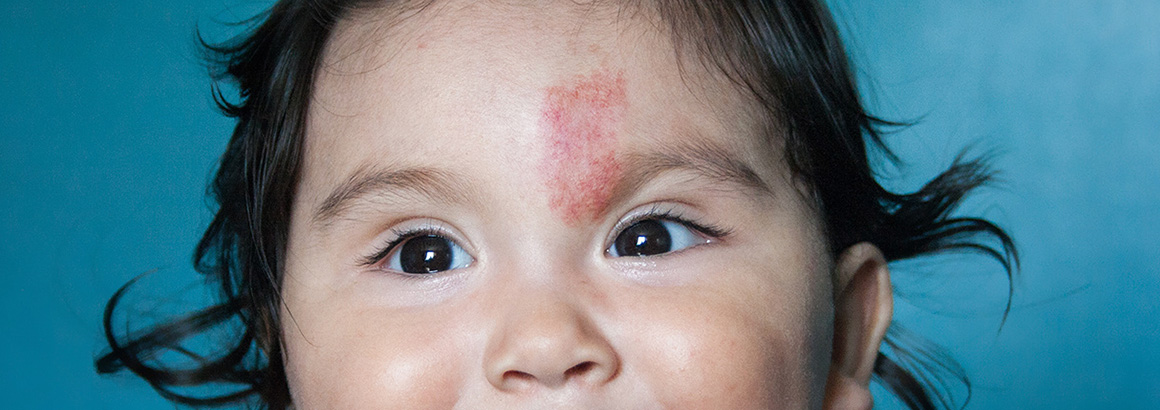 Expecting the Best: Comprehensive Pediatric Plastic Surgery Overview